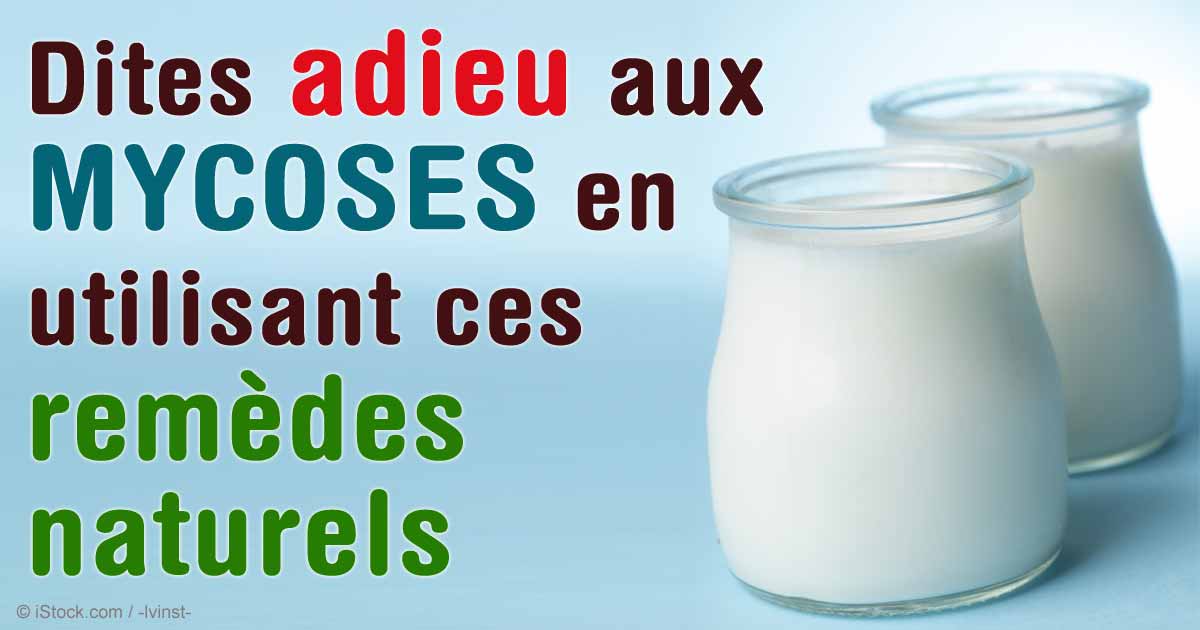 Causes et remèdes naturels contre les mycoses
