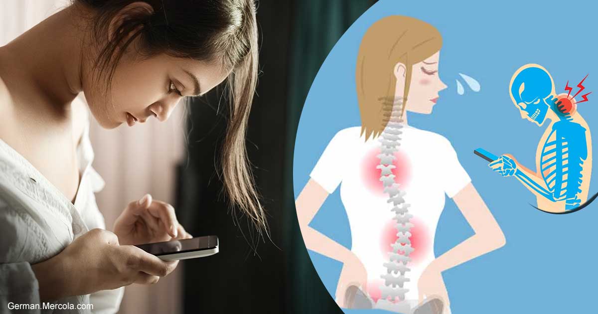 Haltunsprobleme: Entwickeln Sie einen “Smartphone-Nacken”?_Mercola Artikel