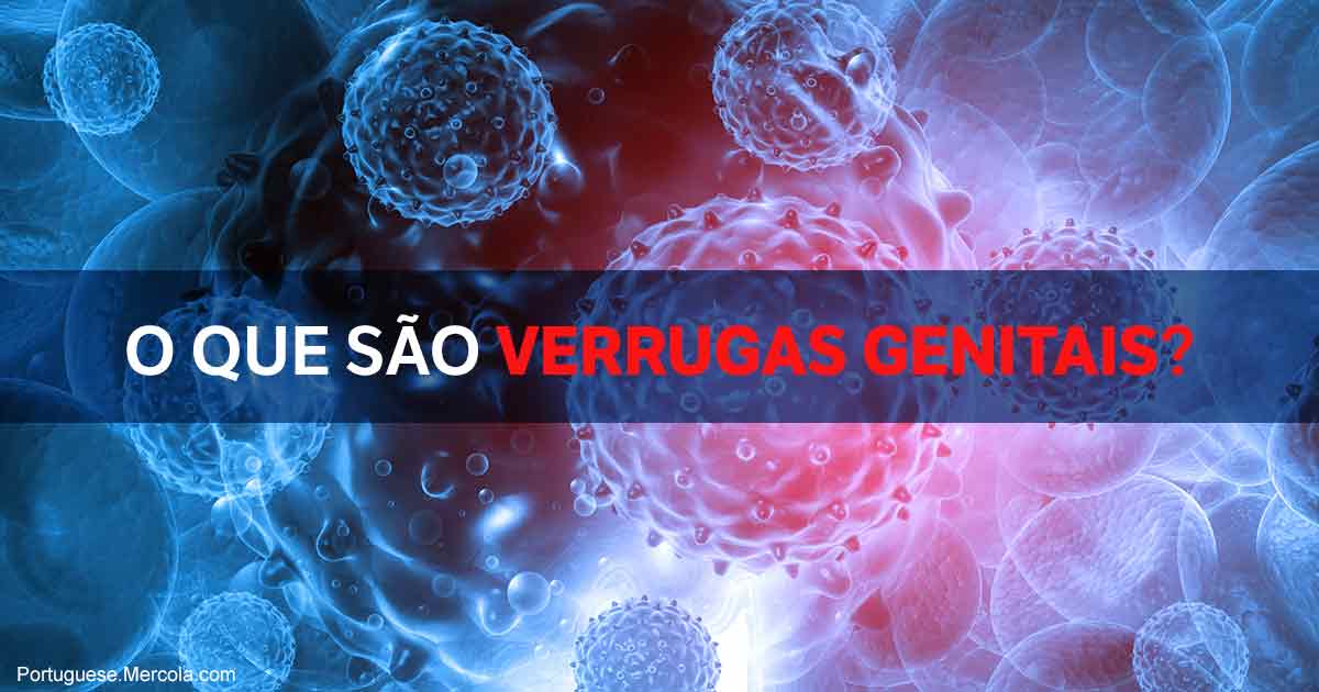 O que são verrugas genitais?